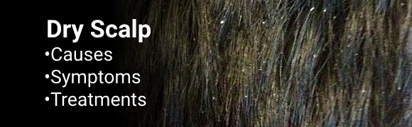 Dry Scalp - Dandruff Deconstructed