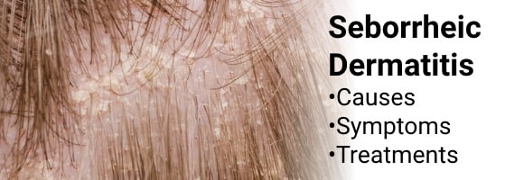 How To Treat Seborrheic Dermatitis | Dandruff Deconstructed