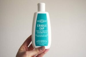 Review :: Dentinox Cradle Cap Baby Shampoo - Dandruff Deconstructed