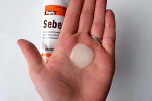 Review :: Sebex Medicated Shampoo - Dandruff Deconstructed