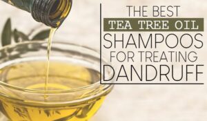 The 10 Best Tea Tree Oil Shampoos For Treating Dandruff - Dandruff ...